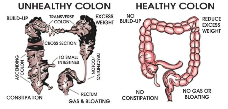 What Is Colonic Hydrotherapy? – Maikong Colon Hydrotherapy Device